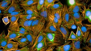 Cell Analysis Solutions | Revvity